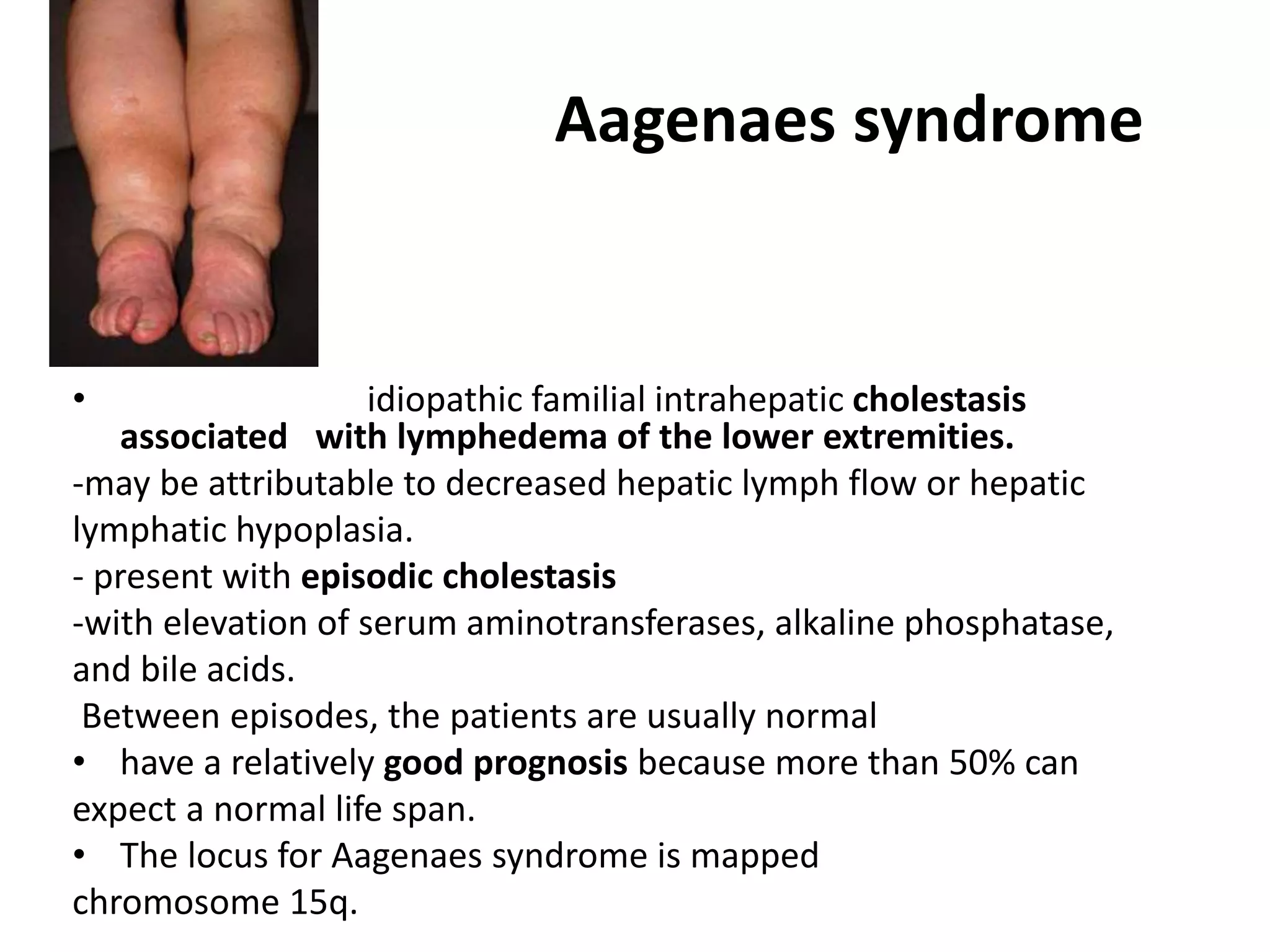 PPT on Neonatal cholestasis by Dr.ajay k chourasia | PPTX