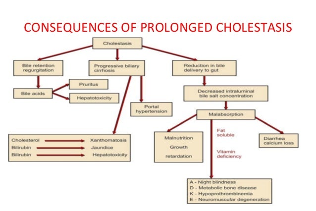 Neonatal cholestasis seminar