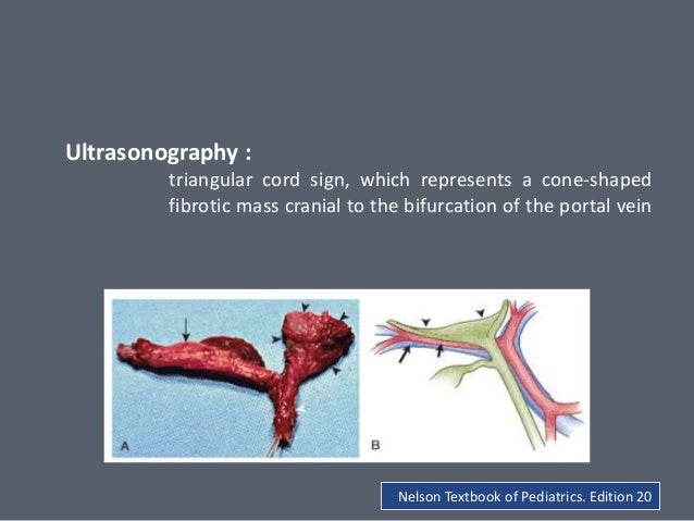 Neonatal cholestasis syndrome