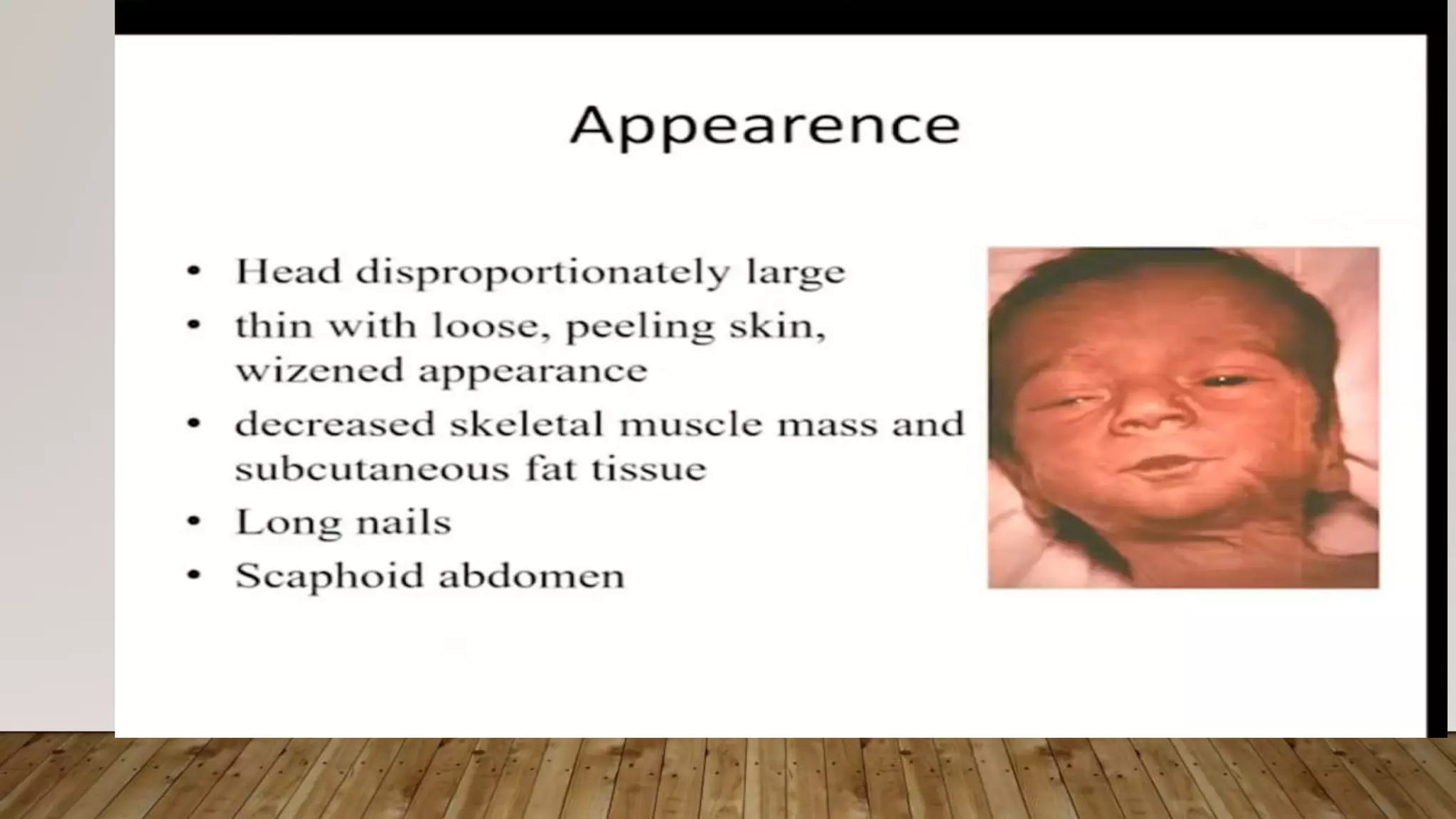 Neonatal complication.pptx