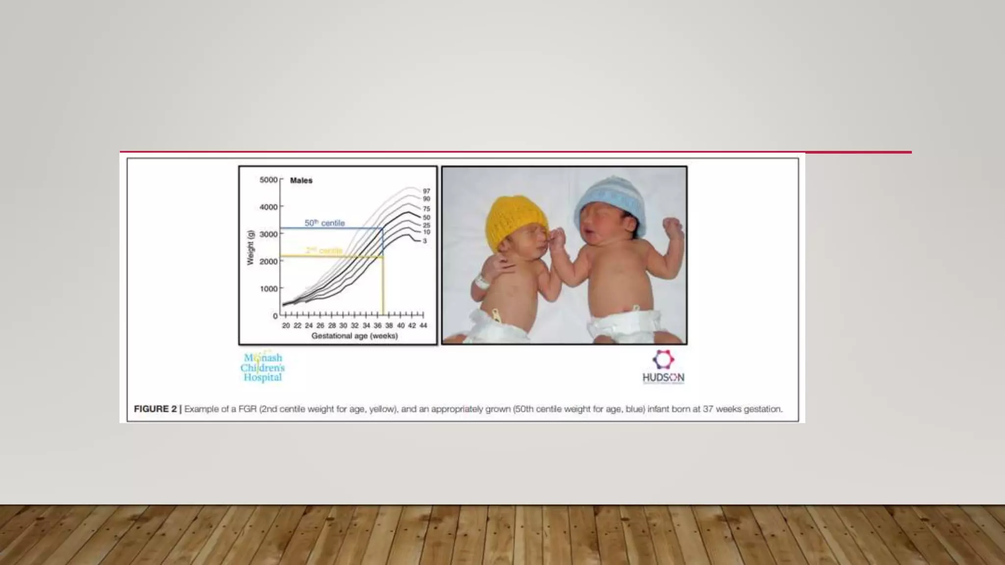 Neonatal complication.pptx