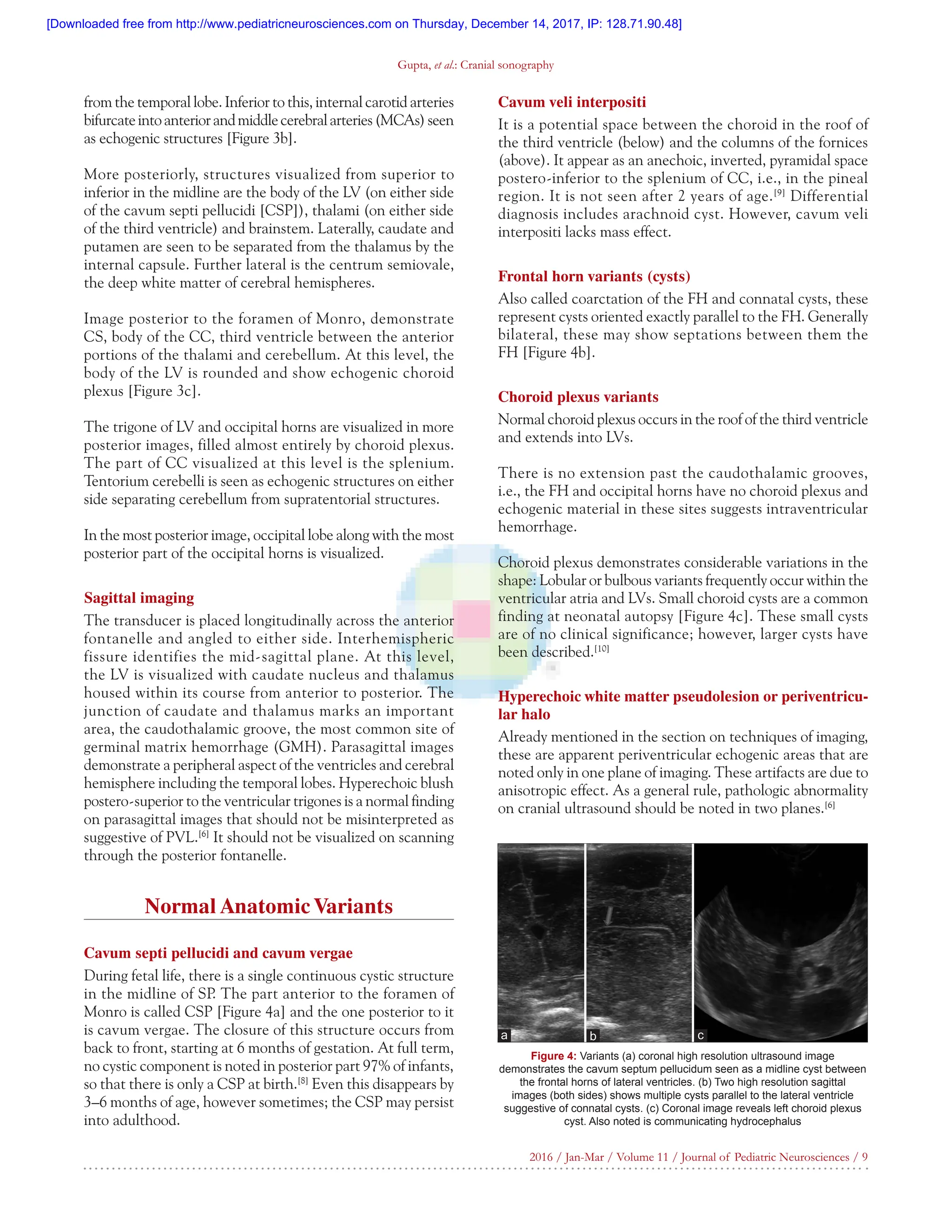 Neonatal_cranial_sonography_A_concise_review_for_c.pdf