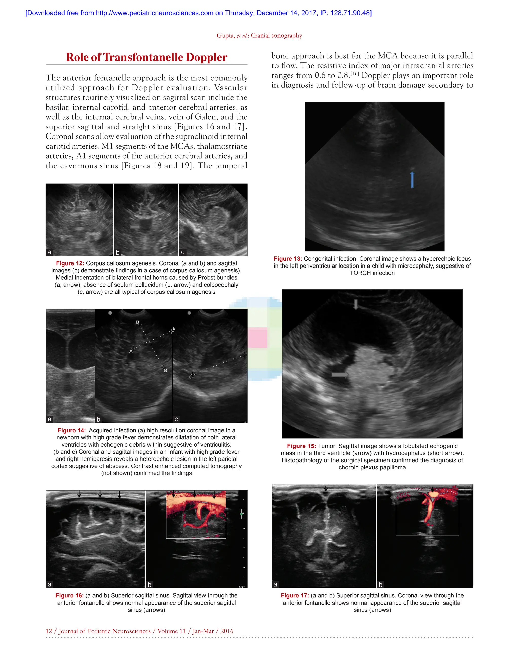 Neonatal_cranial_sonography_A_concise_review_for_c.pdf