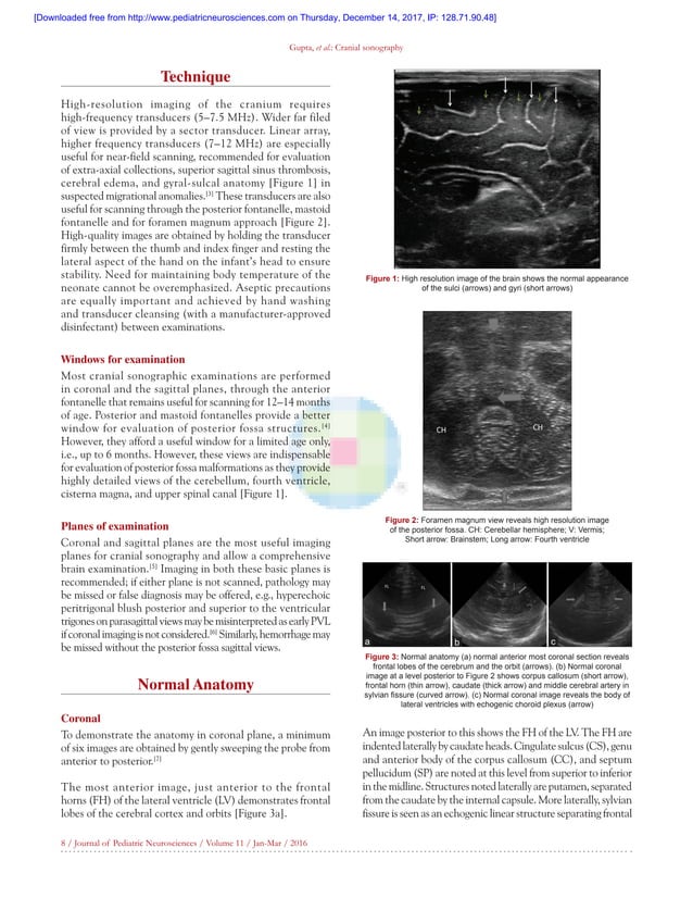 Neonatal_cranial_sonography_A_concise_review_for_c.pdf