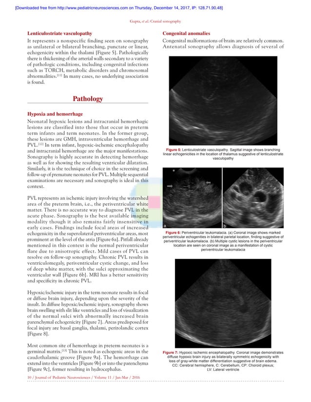 Neonatal_cranial_sonography_A_concise_review_for_c.pdf