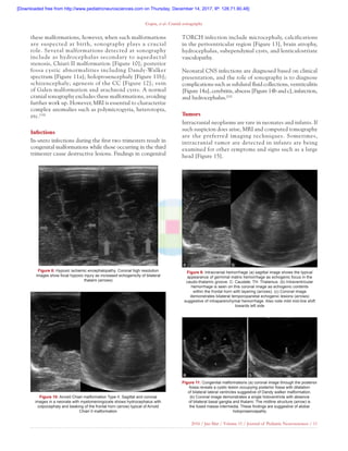Neonatal_cranial_sonography_A_concise_review_for_c.pdf