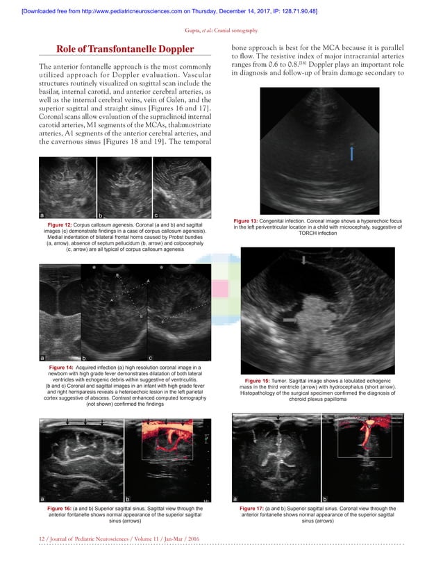 Neonatal_cranial_sonography_A_concise_review_for_c.pdf | Free Download