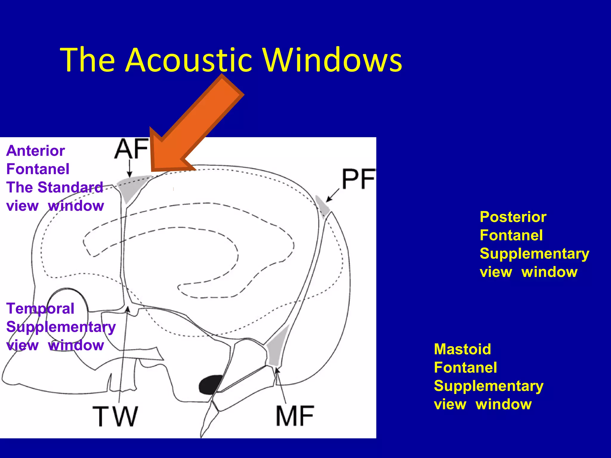 Cranial Ultrasound of neonate | PPT