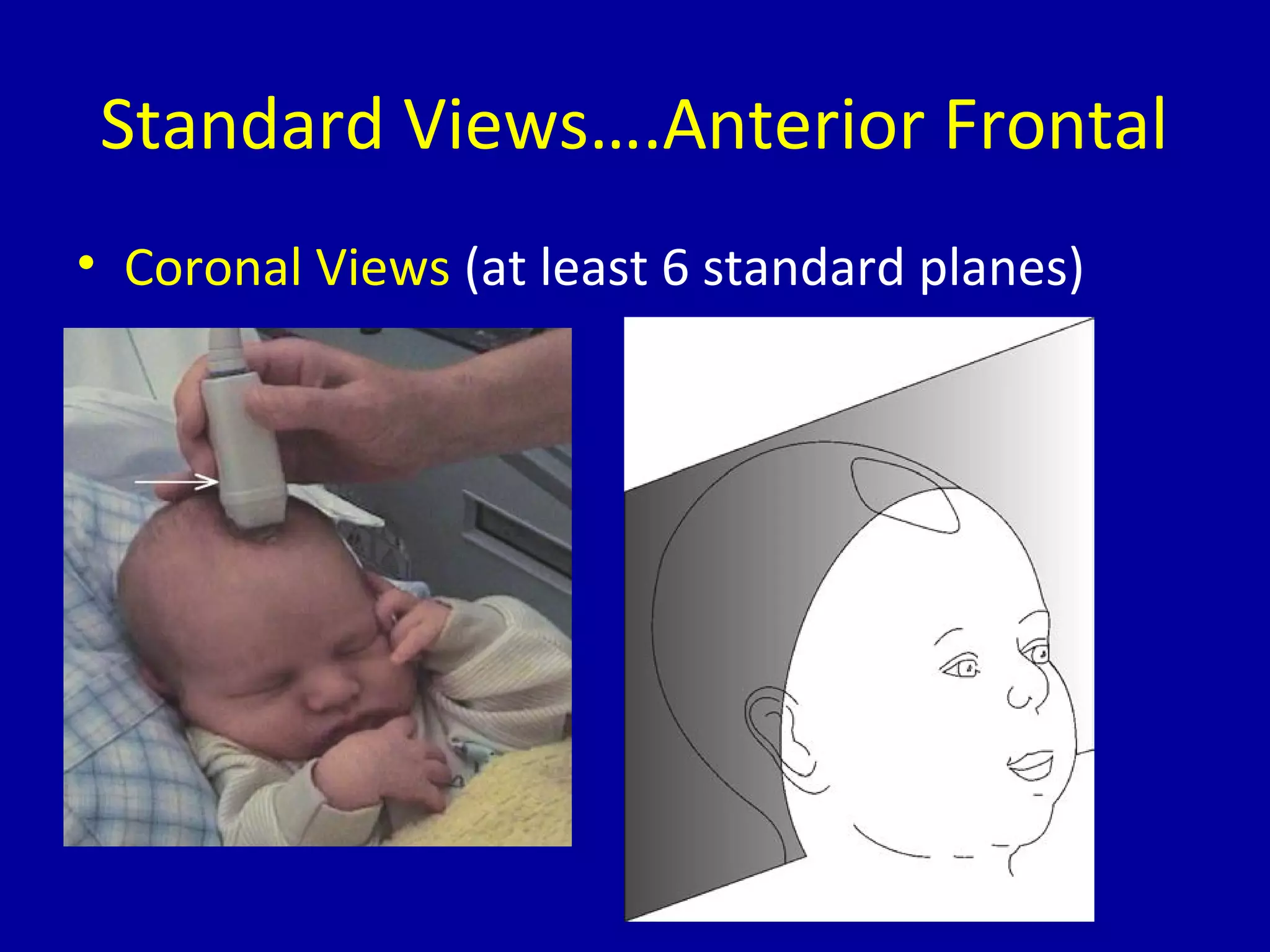 Cranial Ultrasound of neonate | PPT