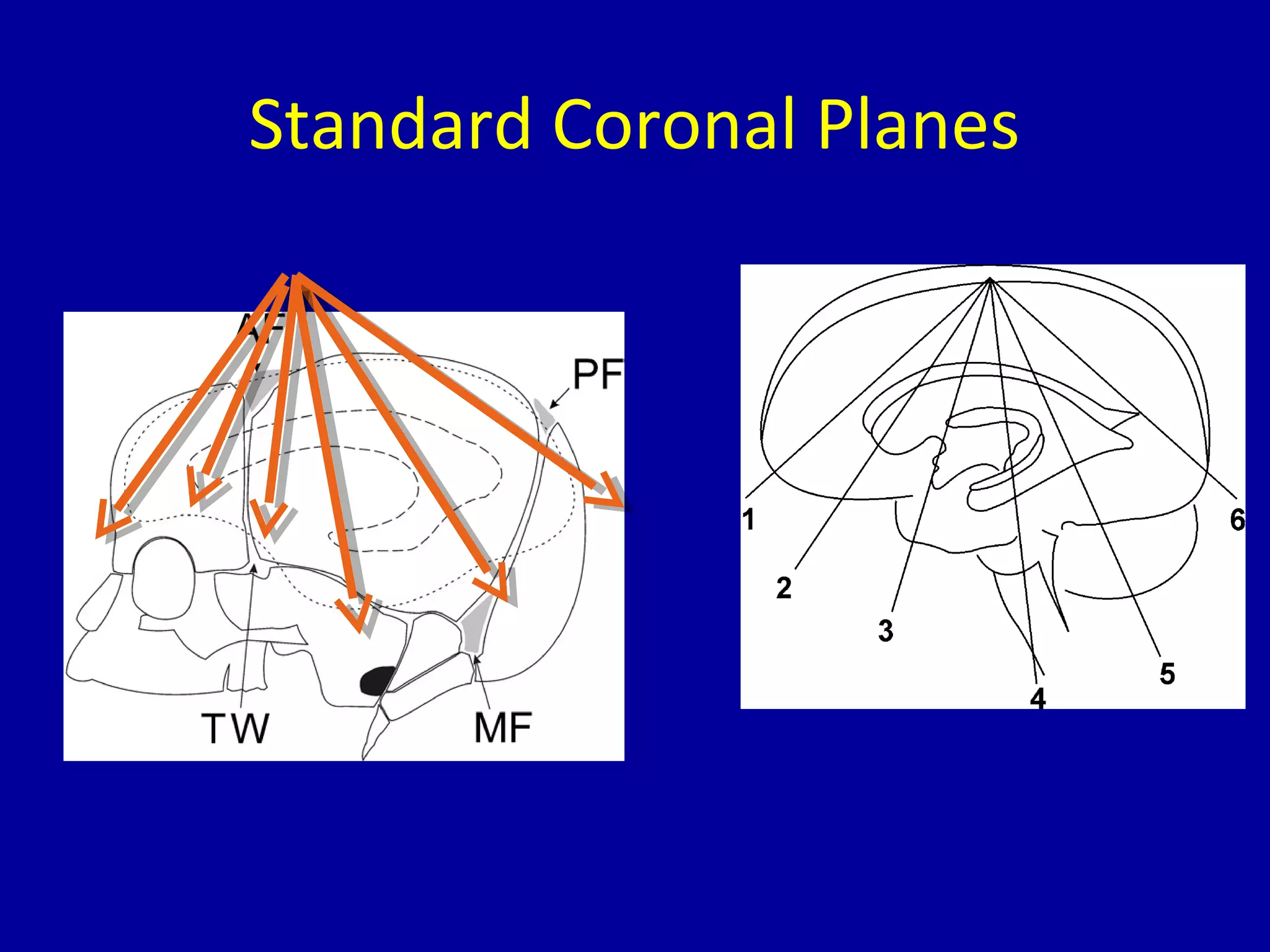 Cranial Ultrasound of neonate | PPT