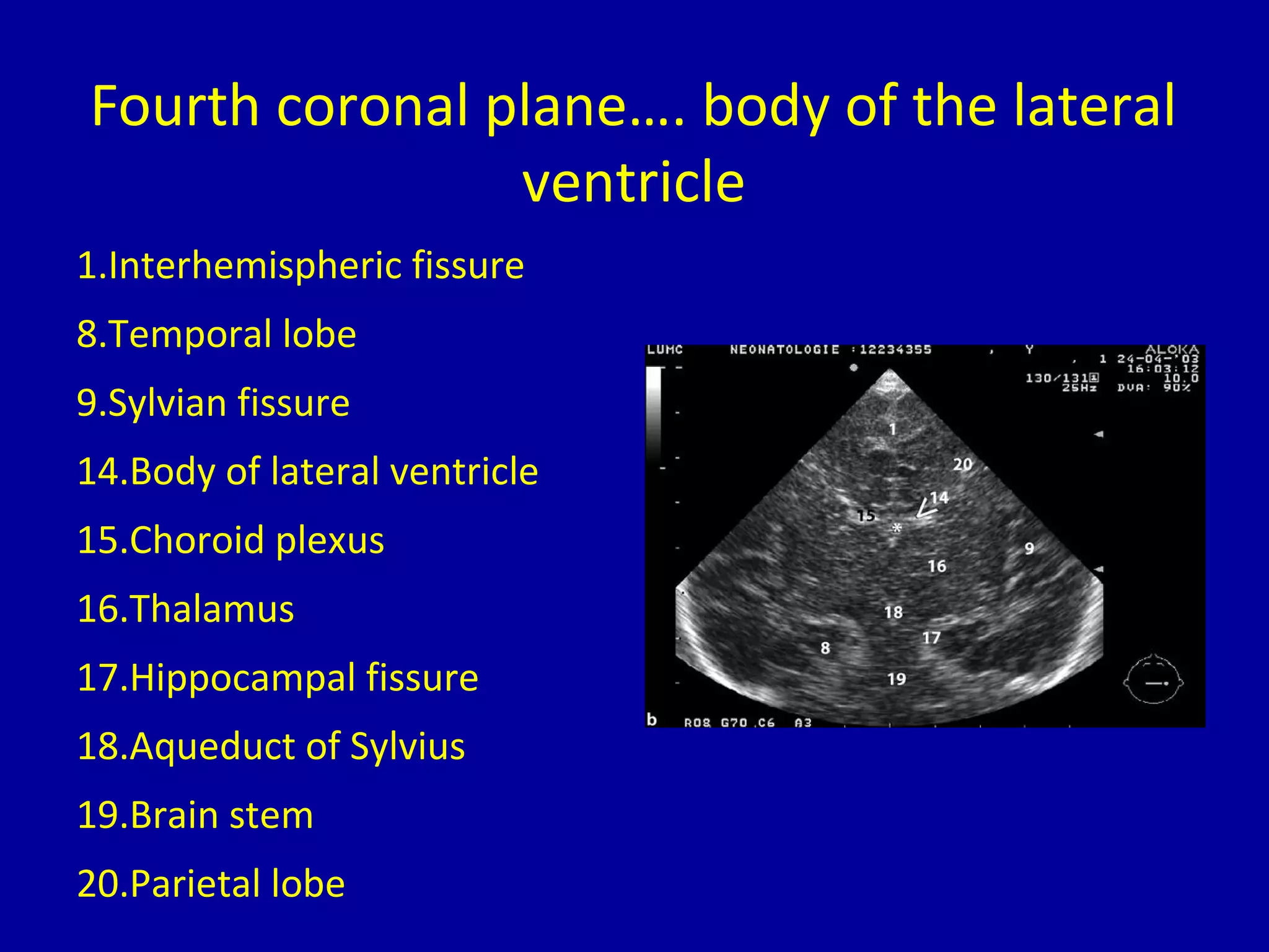 Cranial Ultrasound of neonate | PPT