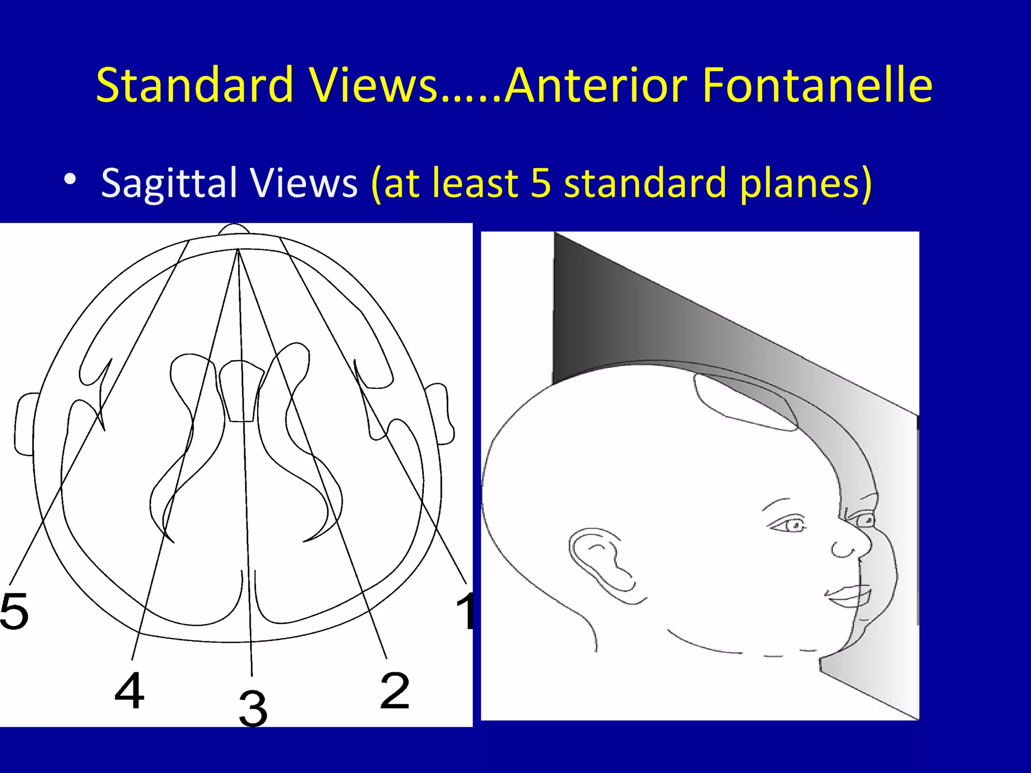Cranial Ultrasound of neonate | PPT