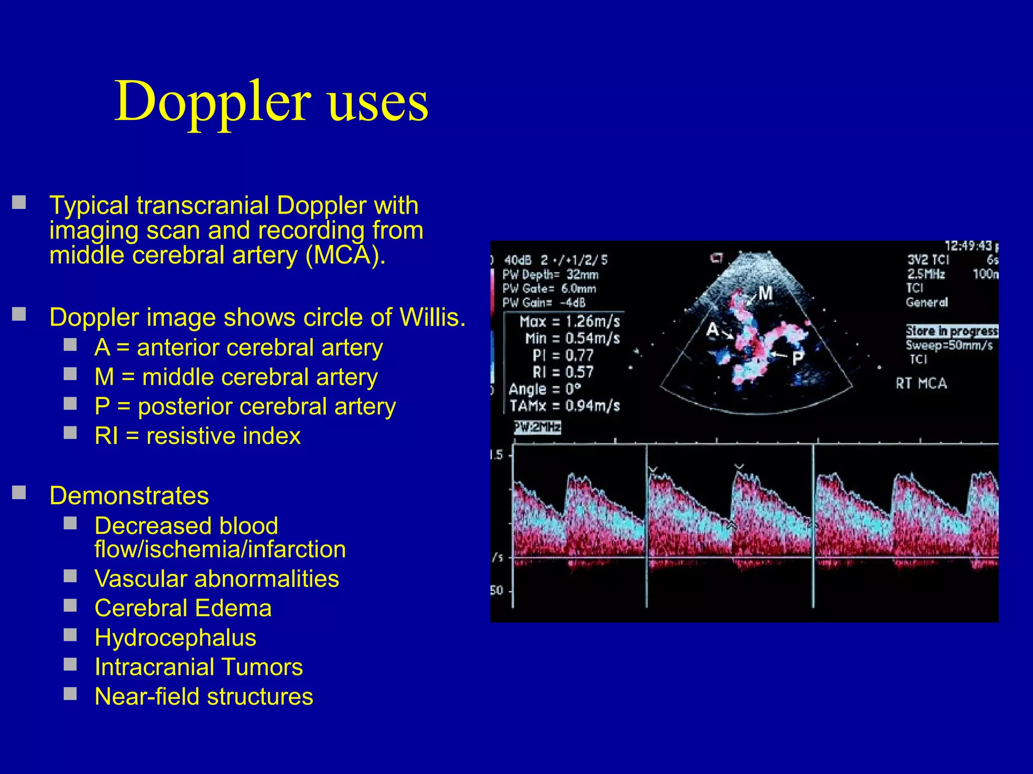 Cranial Ultrasound of neonate | PPT