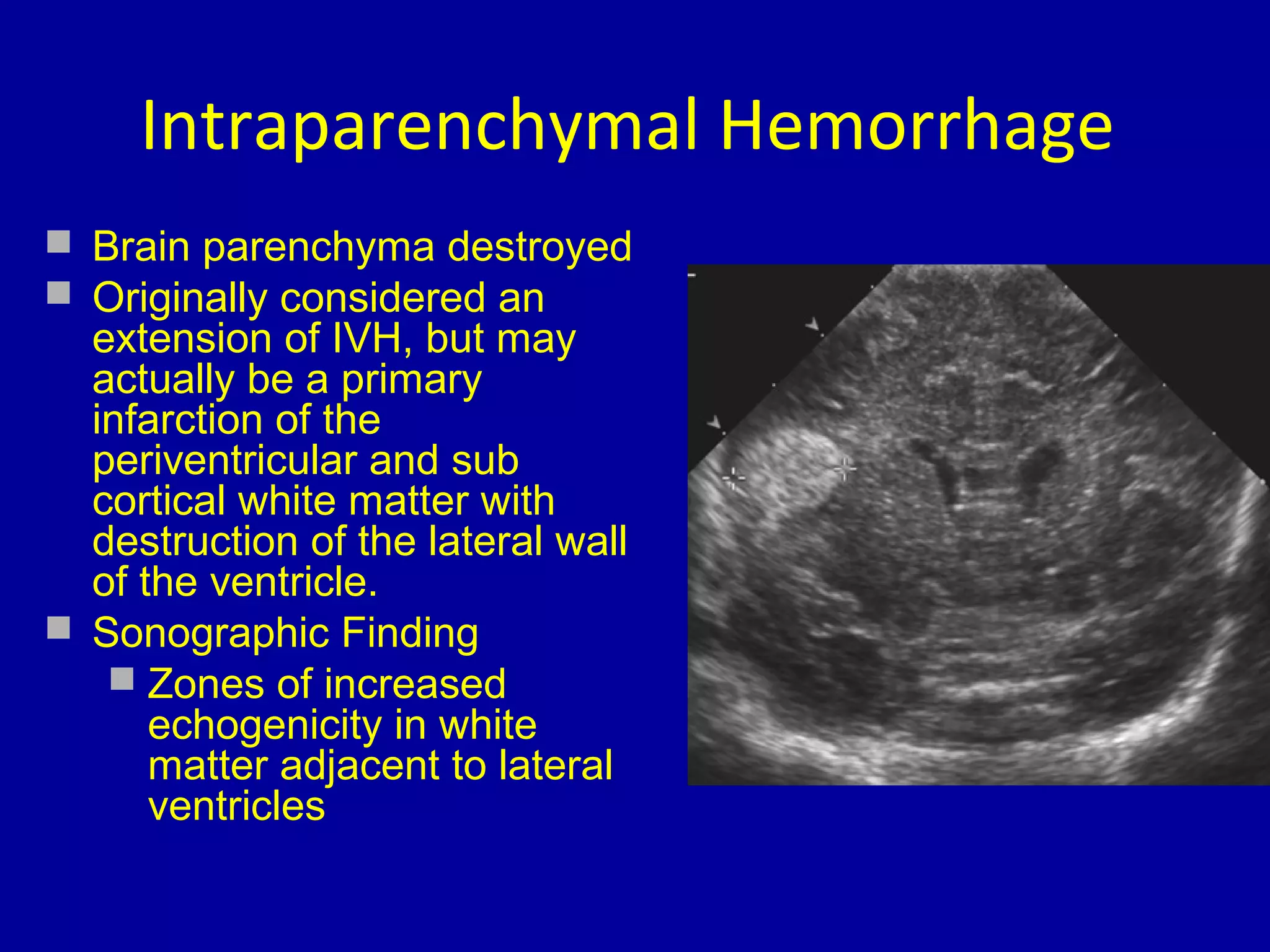 Cranial Ultrasound of neonate | PPT