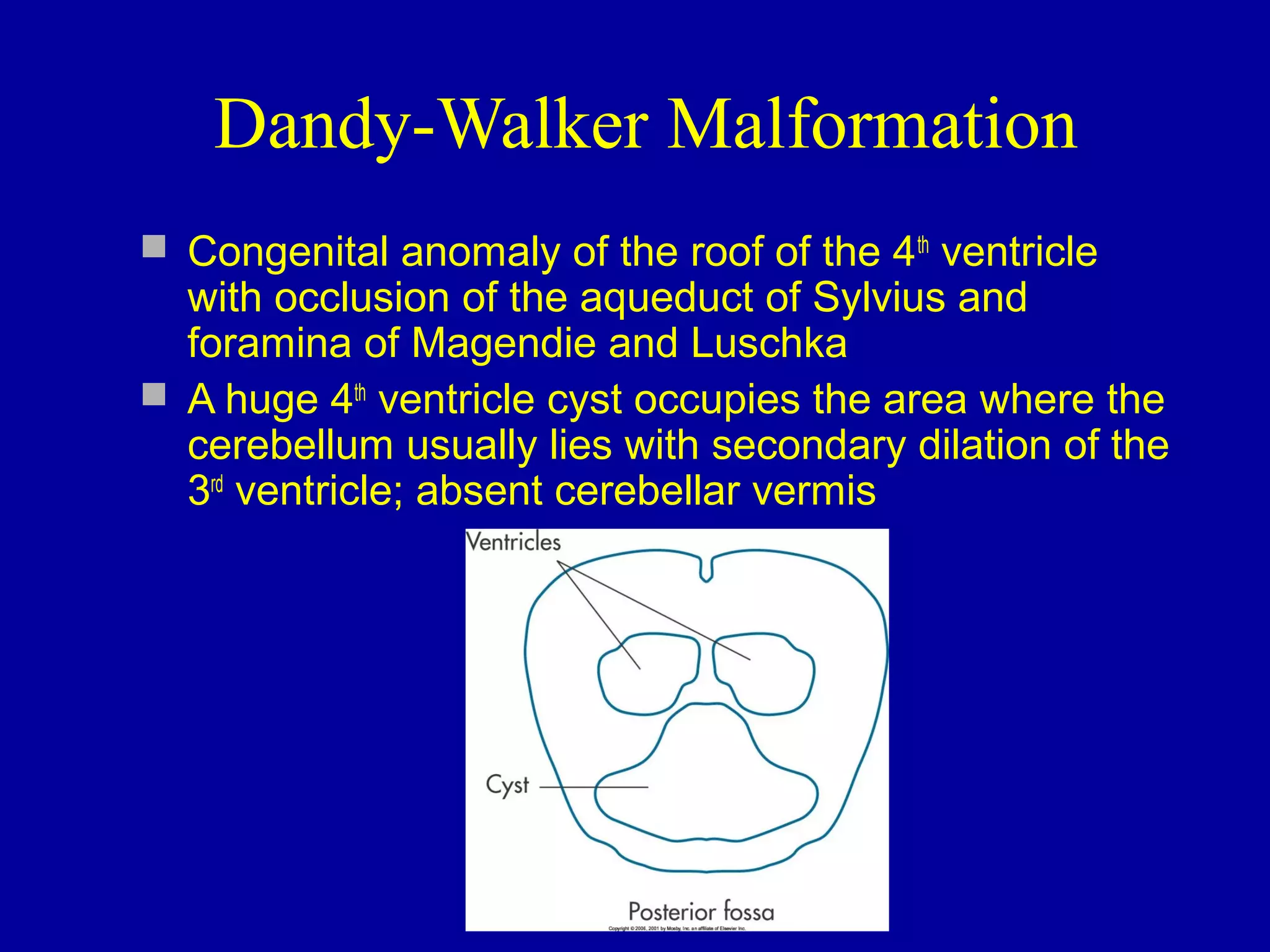 Cranial Ultrasound of neonate | PPT
