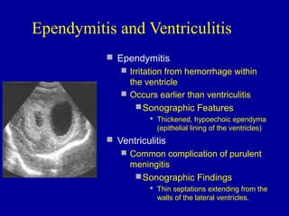 Normal Neonatal Head Ultrasound