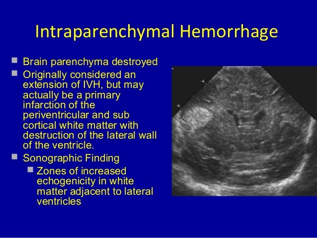 Cranial Ultrasound of neonate