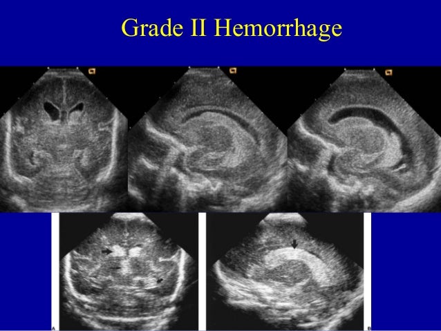 Neonatalcranialusfromatoz 140223095544-phpapp01