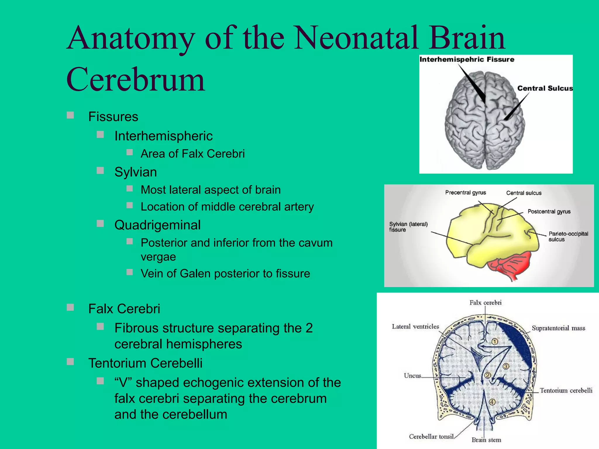 Neonatal cranial us from A to Z | PPT