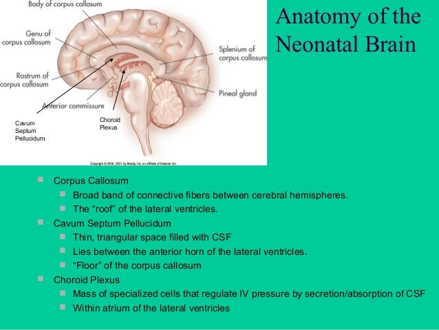 Neonatal cranial us from A to Z