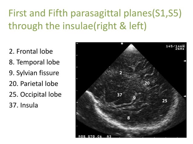 Neonatal transcranial USG | PPT | Medical Health