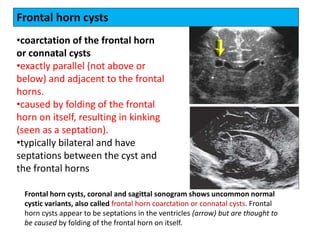 Neonatal transcranial USG | PPT