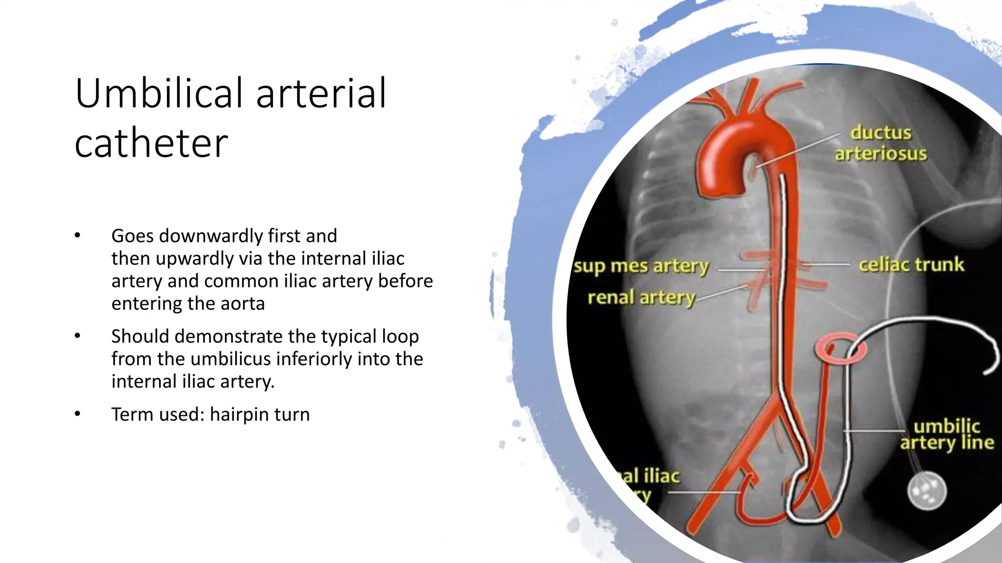 Neonatal Chest X-Ray | PPTX
