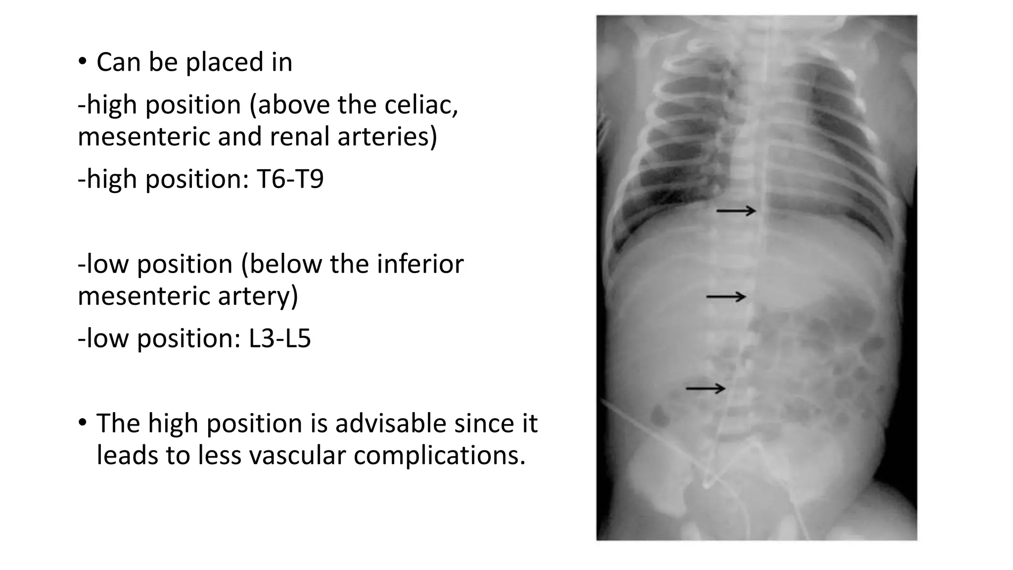 Neonatal Chest X-Ray | PPTX