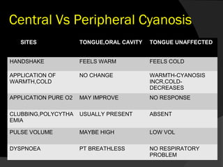 Central Cyanosis Vs Peripheral Cyanosis