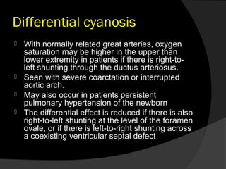 Differential Cyanosis