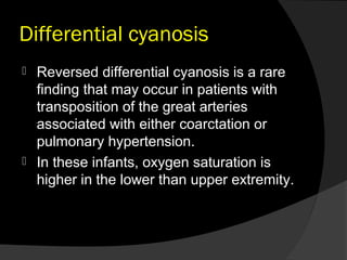 Differential Cyanosis