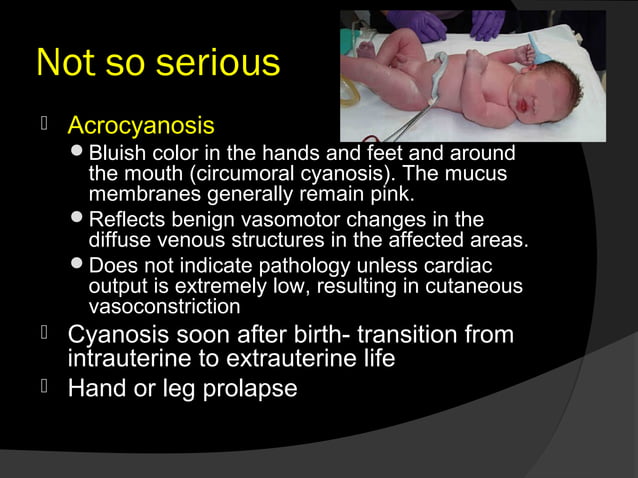 Approach to a Neonate with Cyanosis | PPT