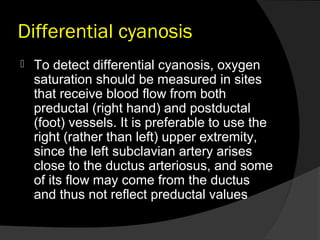 Reverse Differential Cyanosis