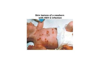 Neonatal dermatoses | PPTX