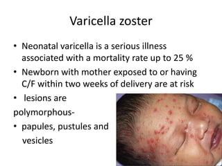 Neonatal dermatoses | PPTX
