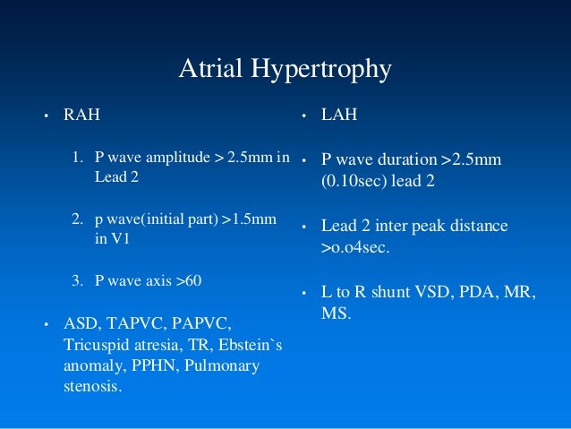 Neonatal ecg part2
