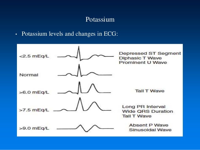 Neonatal ecg part2