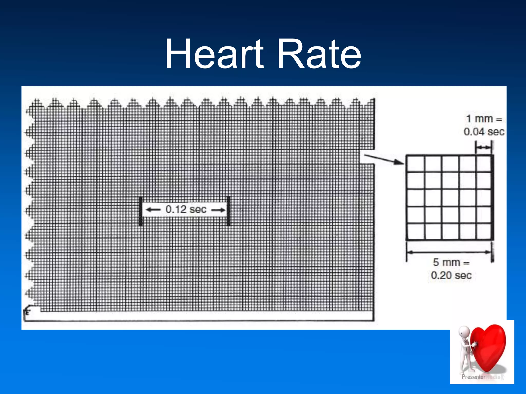 Neonatal ekg | PPTX