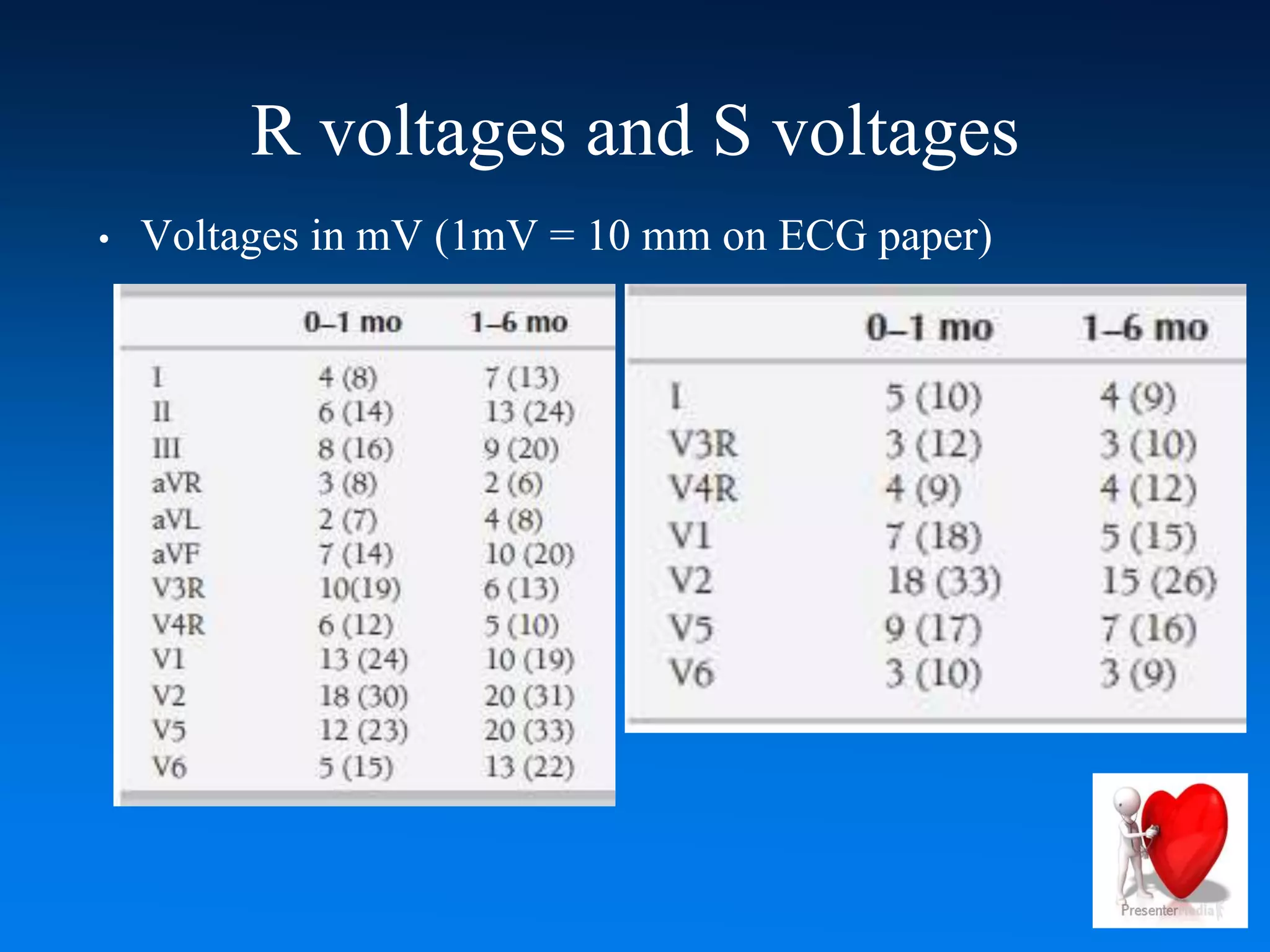 Neonatal ekg | PPTX