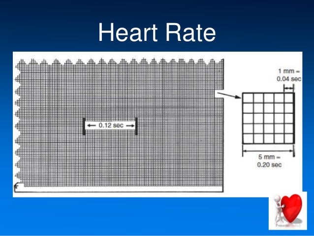 Neonatal ekg