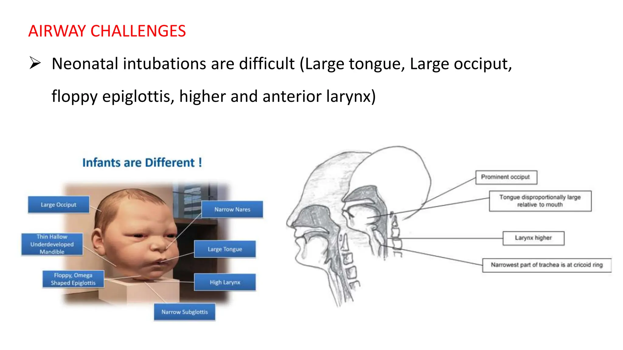 Anaesthesia challenges in neonatal emergencies-1.pptx
