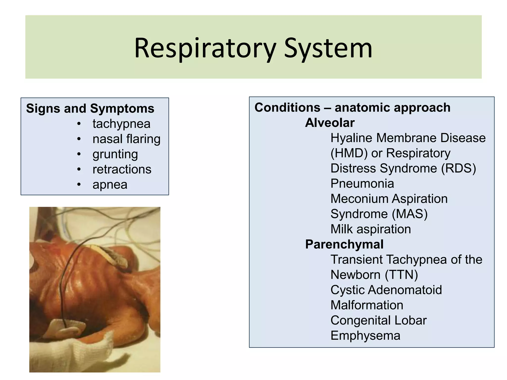 Neonatal emergencies | PPTX