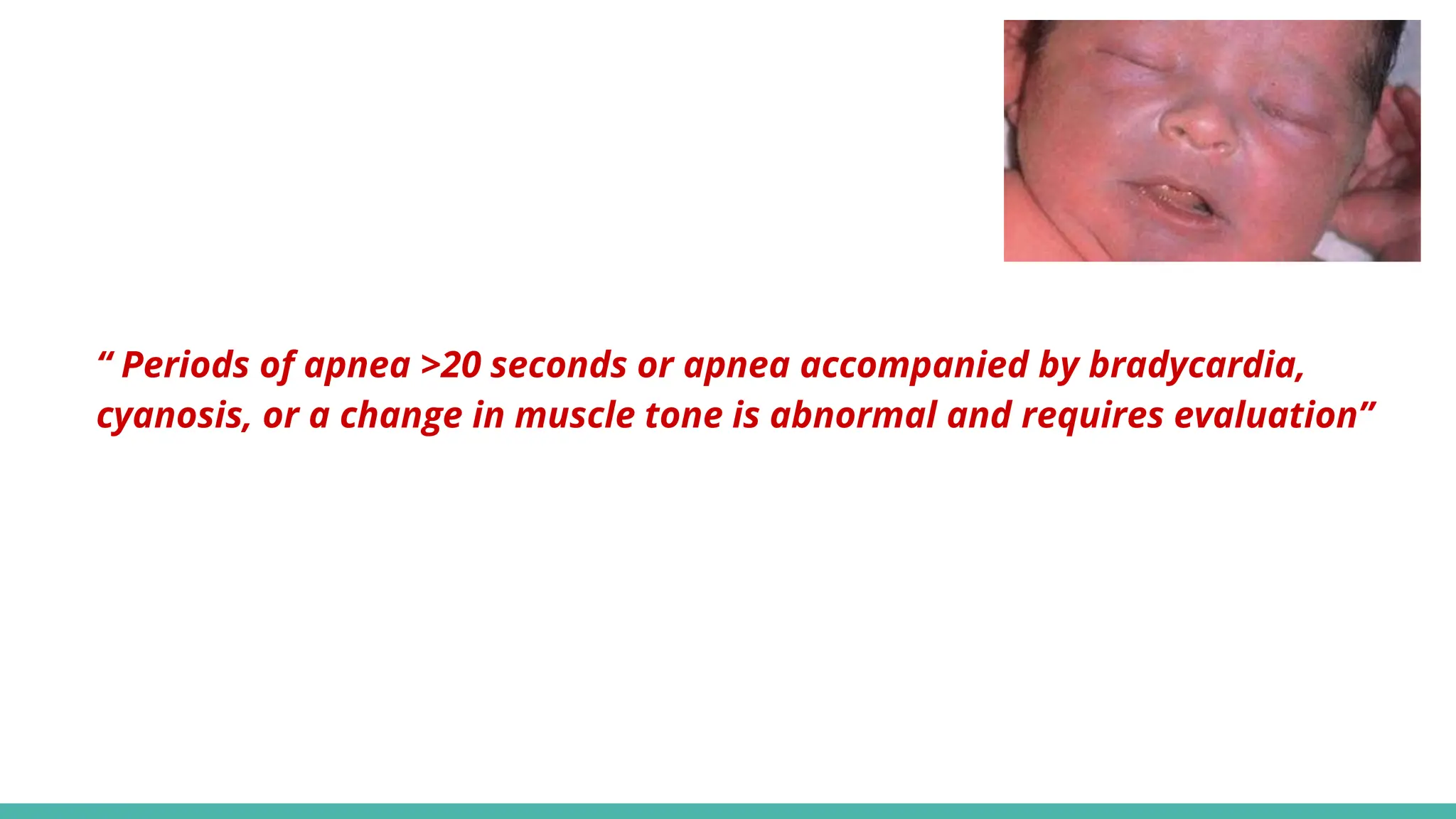 Neonatal Emergencies final (1).pptx