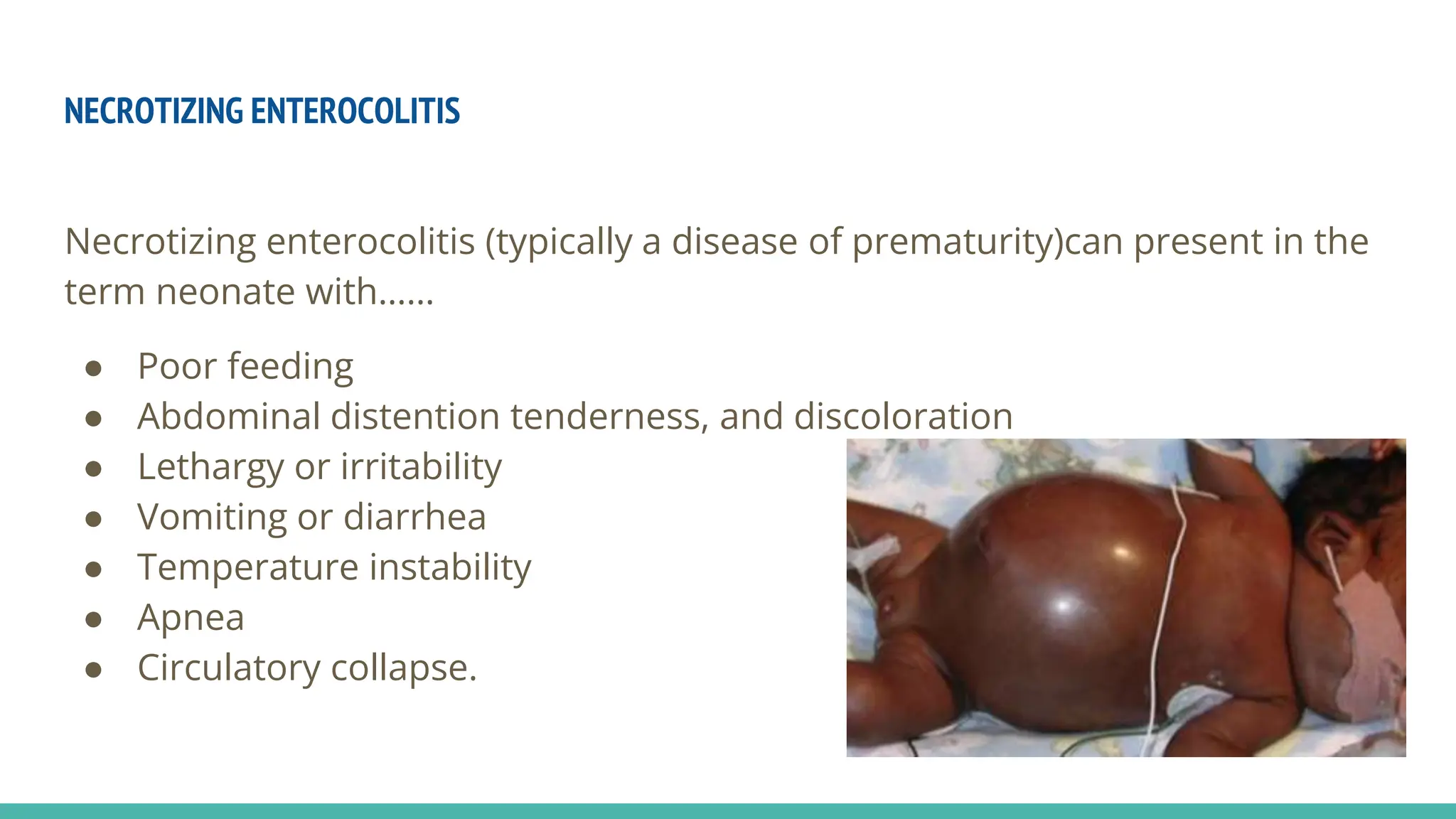 Neonatal Emergencies final (1).pptx