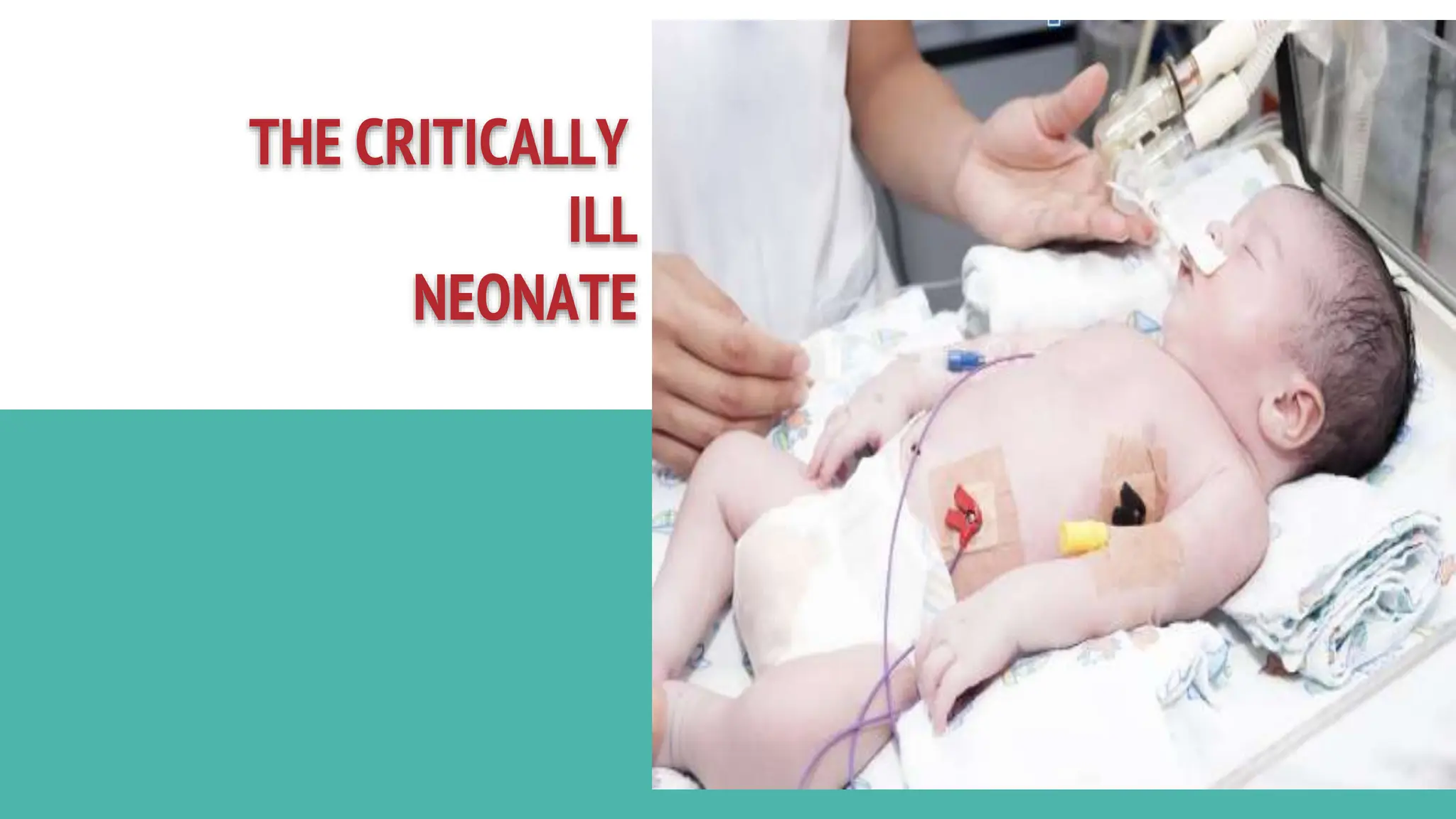 Neonatal Emergencies final (1).pptx
