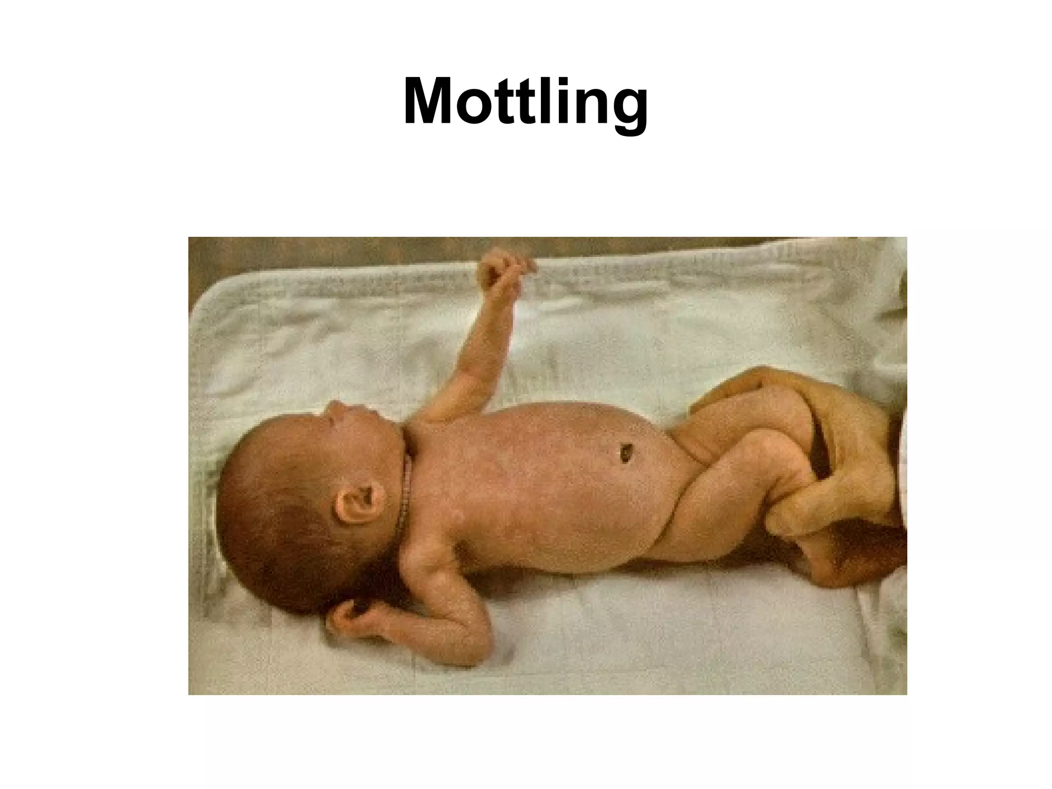 Neonatal examination | PPT