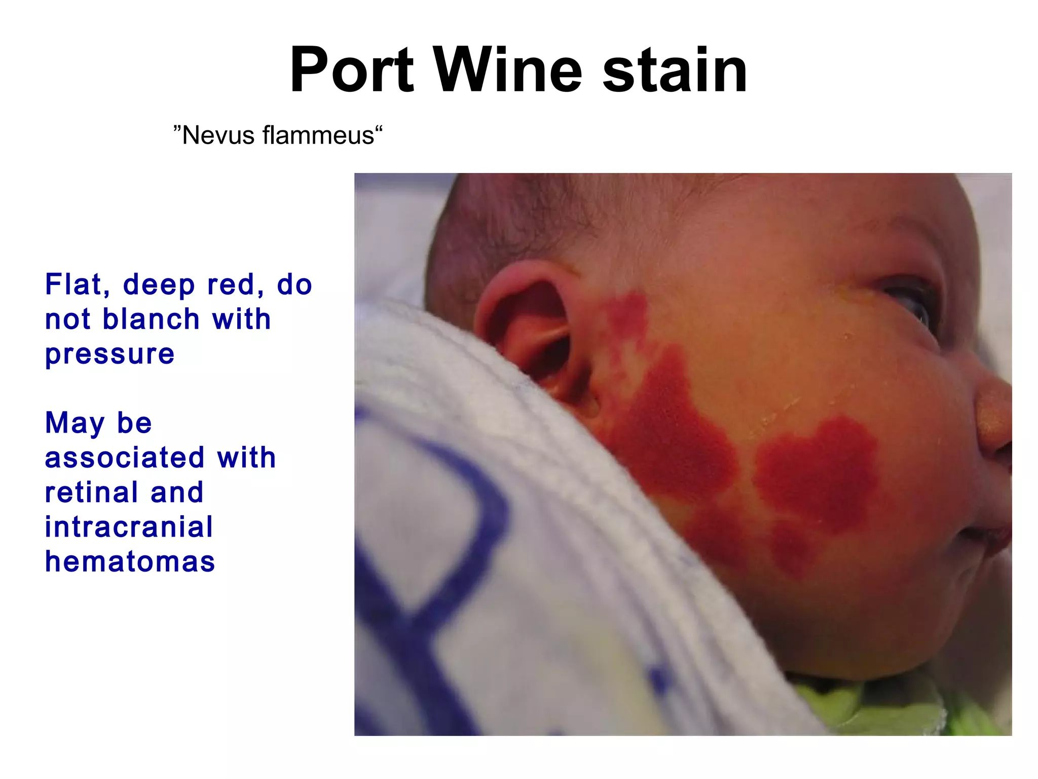 Neonatal examination | PPT