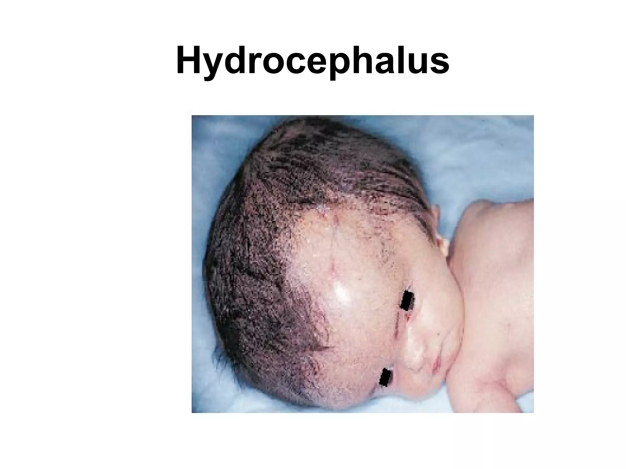 Neonatal examination | PPT
