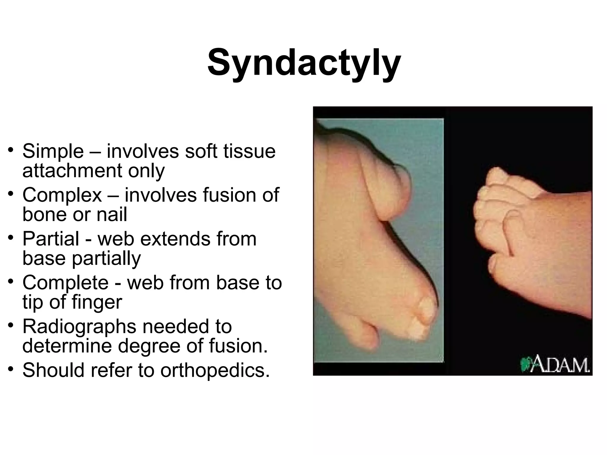 Neonatal examination | PPT