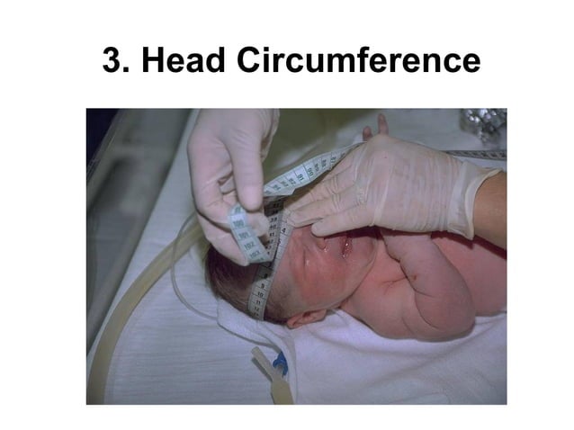 Neonatal examination | PPT